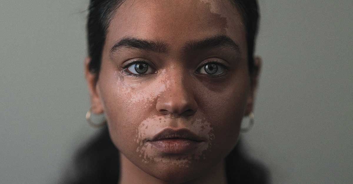 More than Skin Deep - alive magazine